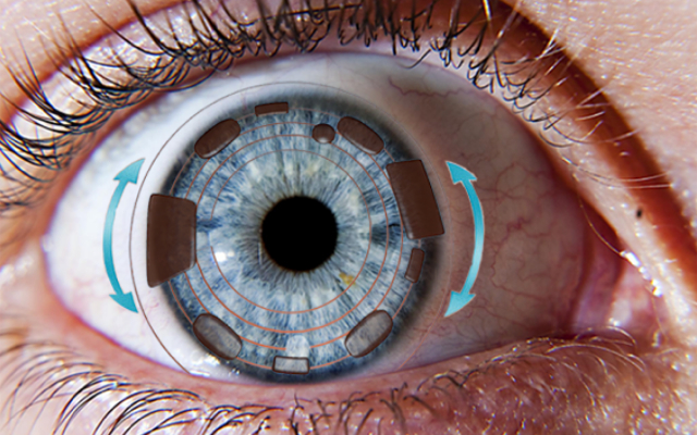 CES: The Era of Screens in Contact Lenses May Be Upon Us - ETCentric